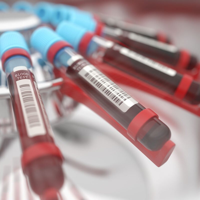 6 Alasan Hemoglobin Rendah Dan Penanganannya - Cairo Food